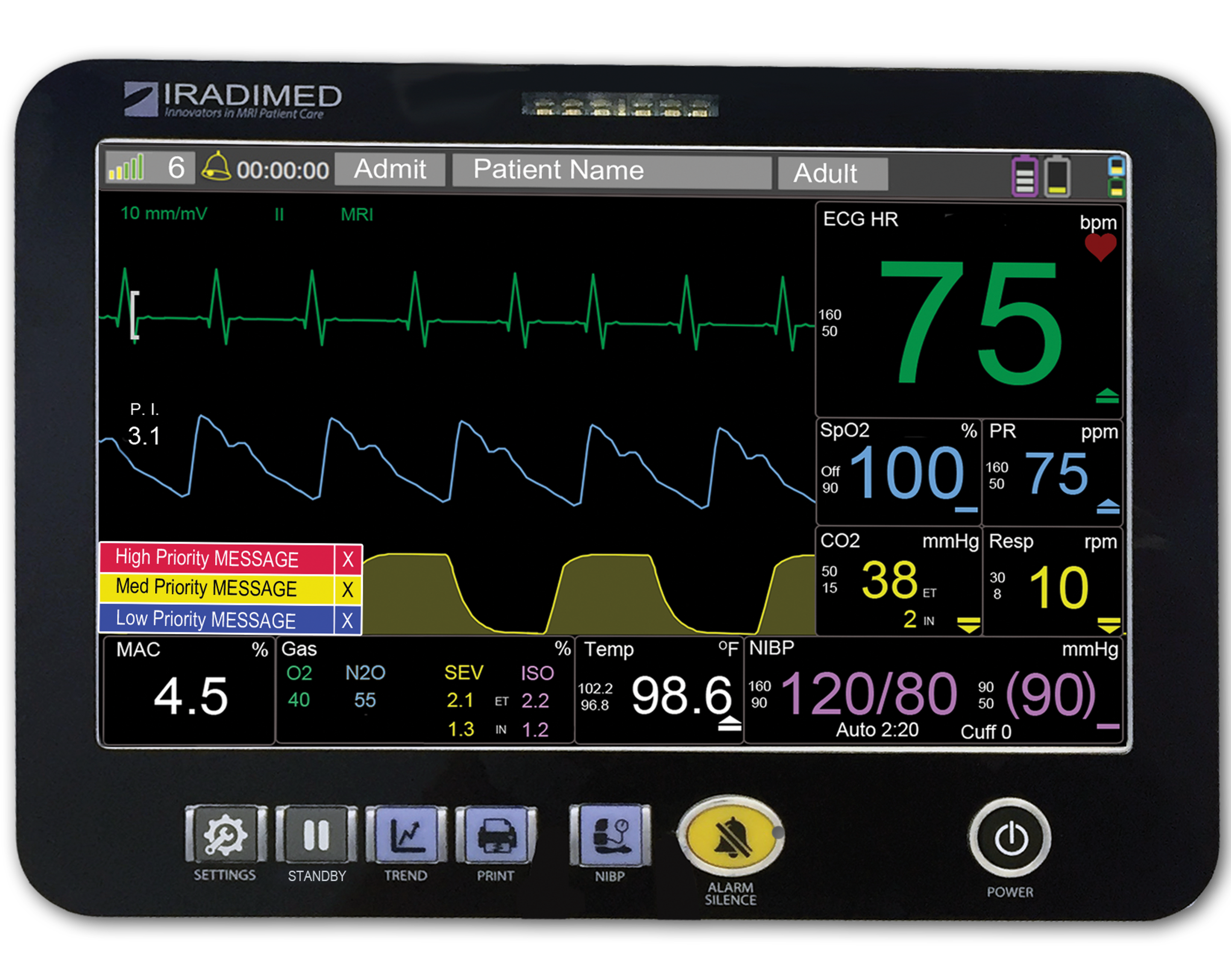 3880 MRI Patient Monitor — IRadimed 3880 MRI Patient Monitor — IRadimed