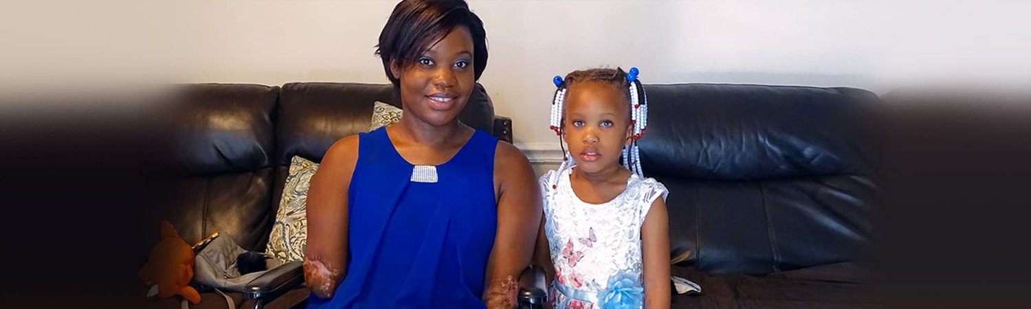 Kayleigh’s Sepsis Story - Quadruple Amputee Turning Tragedy into ...