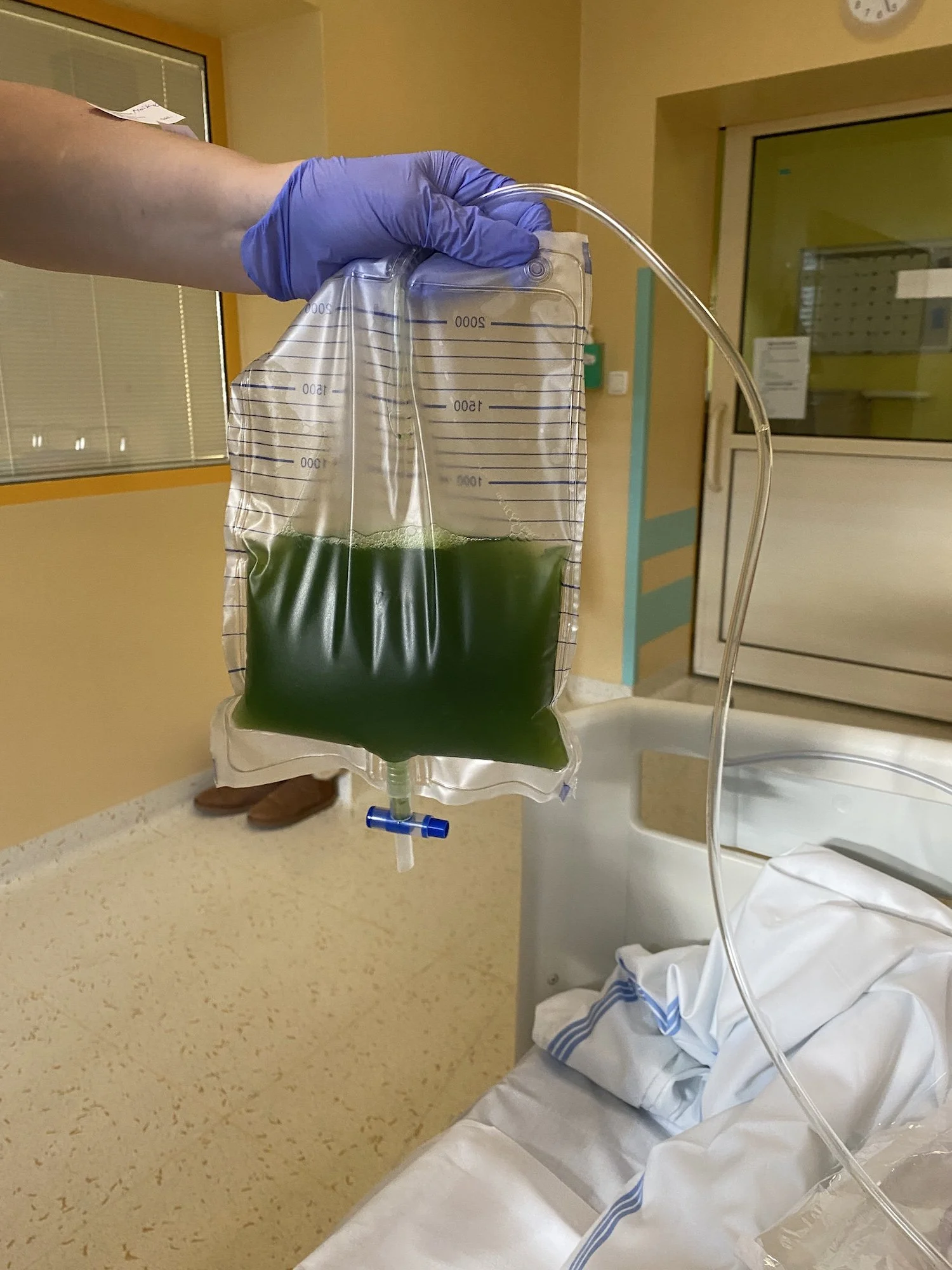 Tereza’s Sepsis Story – From Fit to Sepsis and Back Again — World ...