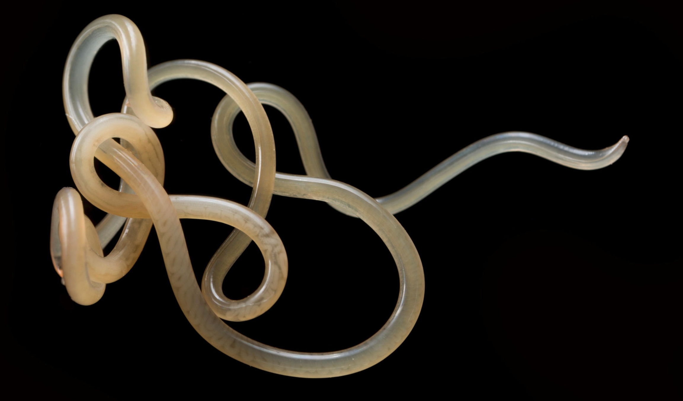 INTESTINAL PARASITES CAN CAUSE ALL KINDS OF HEALTH PROBLEMS AND HARM ...