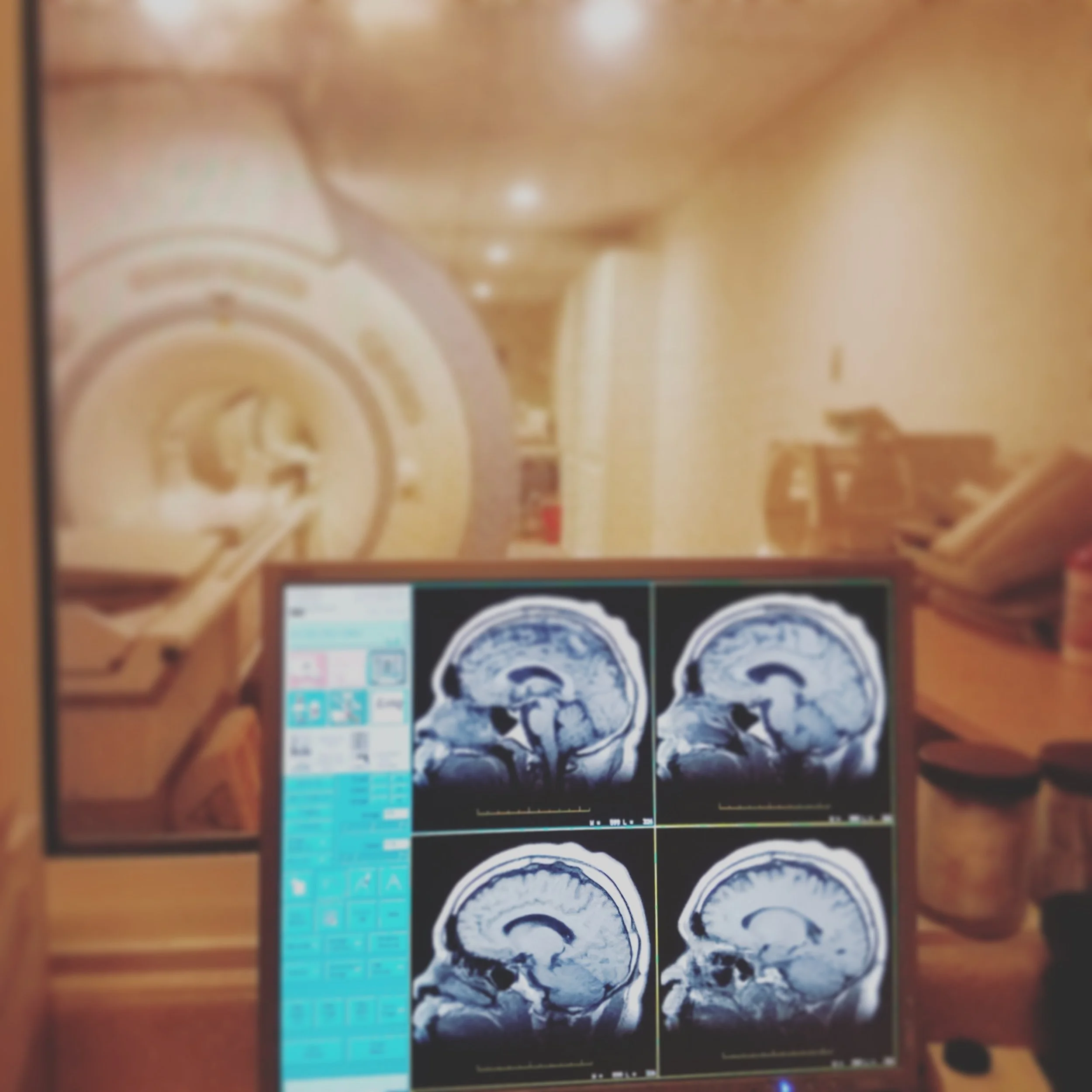 MRI M.R.I. MAGNETIC RESONANCE IMAGING SCANS — Dedicated Medical Imaging ...