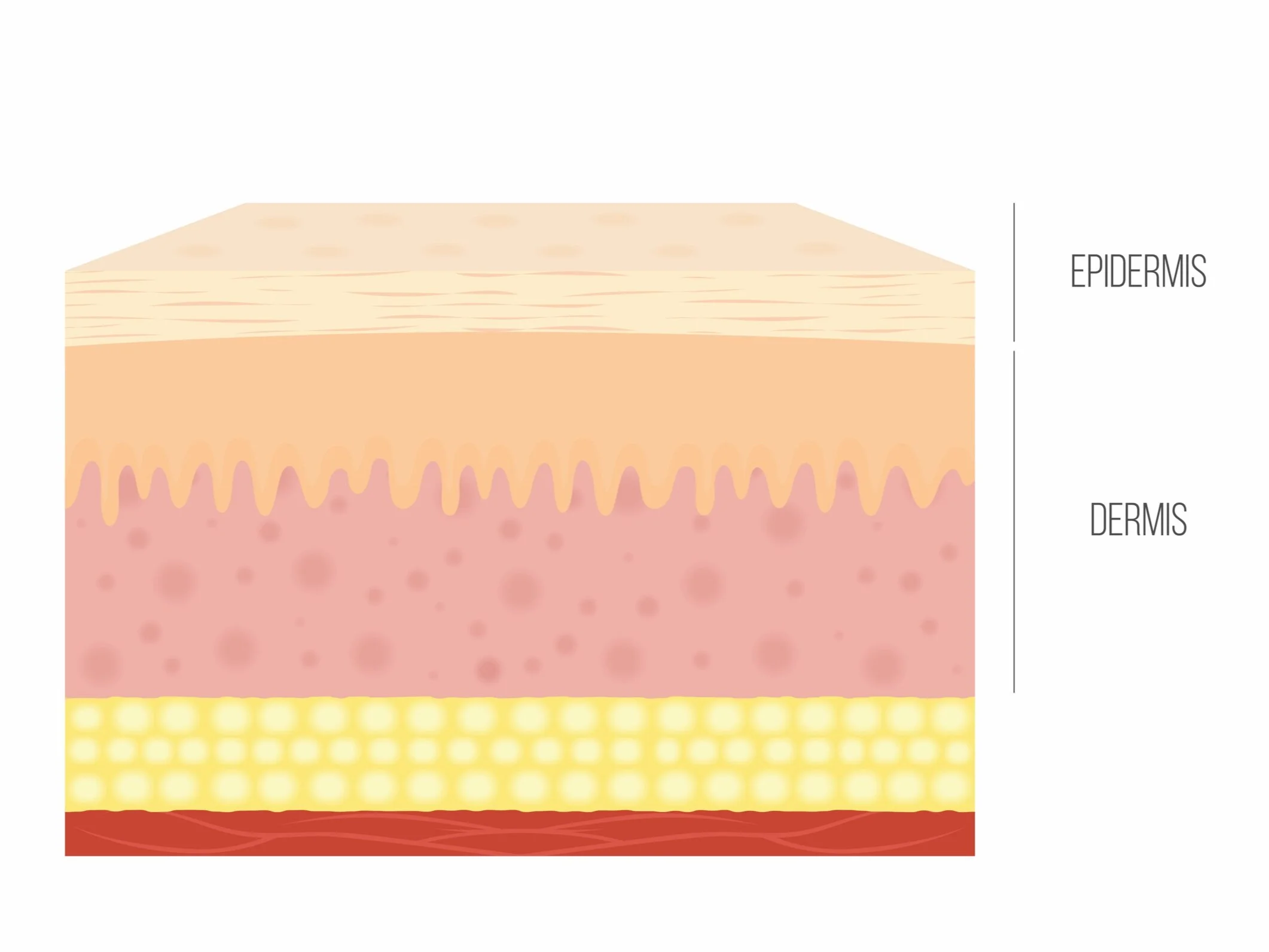 The Ultimate Treatment Guide to MicroLaser Peel + Profrational Laser ...