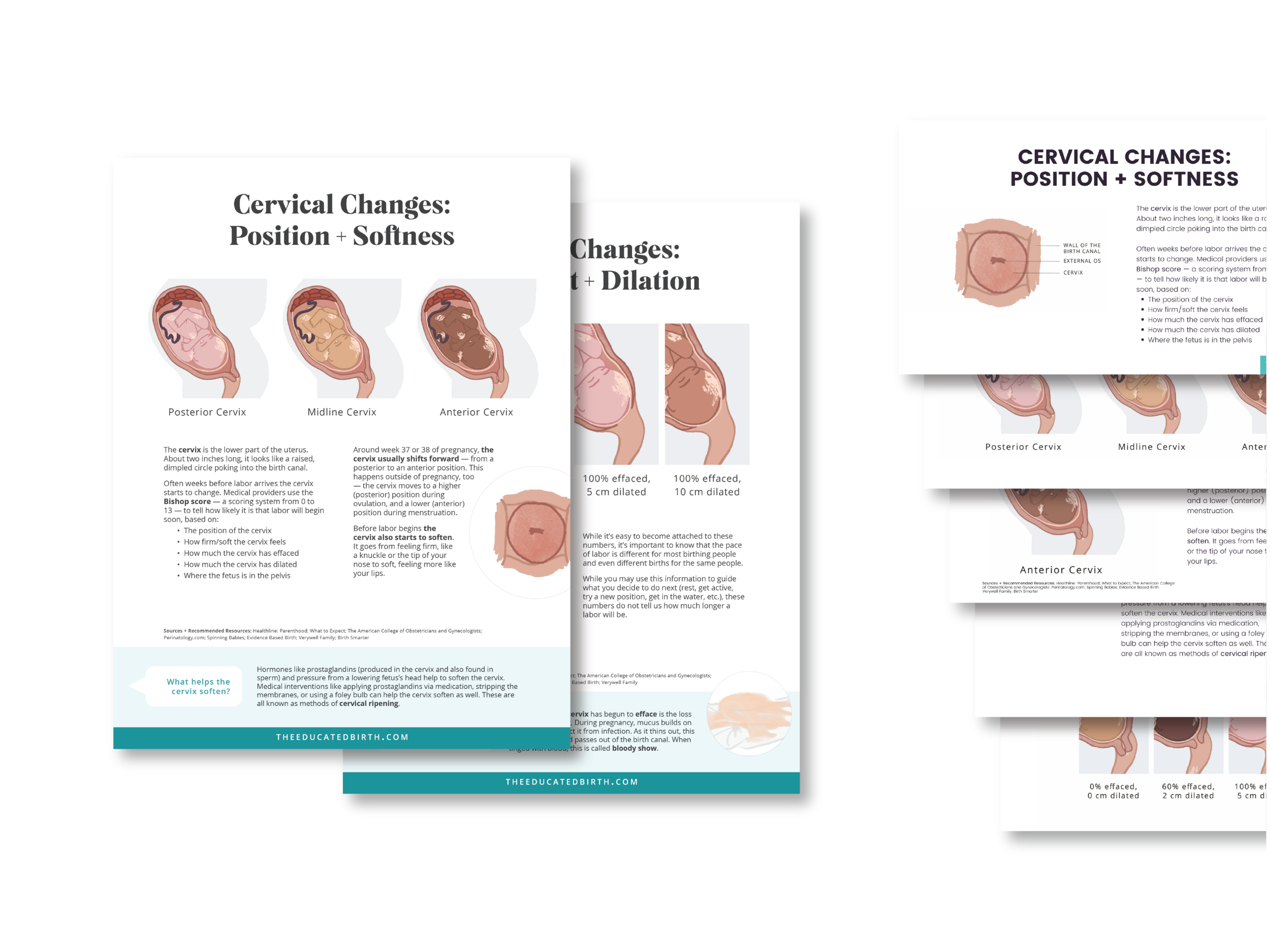 Process Of Birth Infographic Bundle Basic Use The Educated Birth