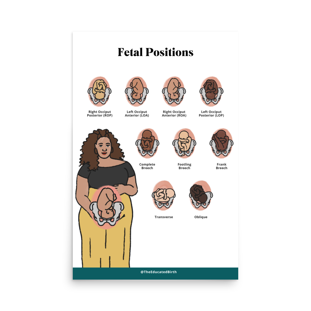 Oblique Position Baby