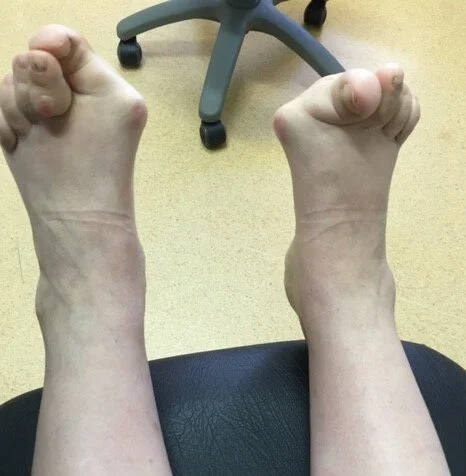 Cold feet??? — Footrix Podiatry