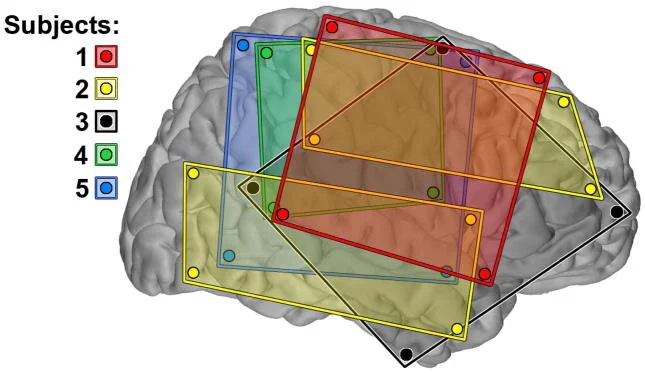 Brain Computer Interface — Sun Laboratory