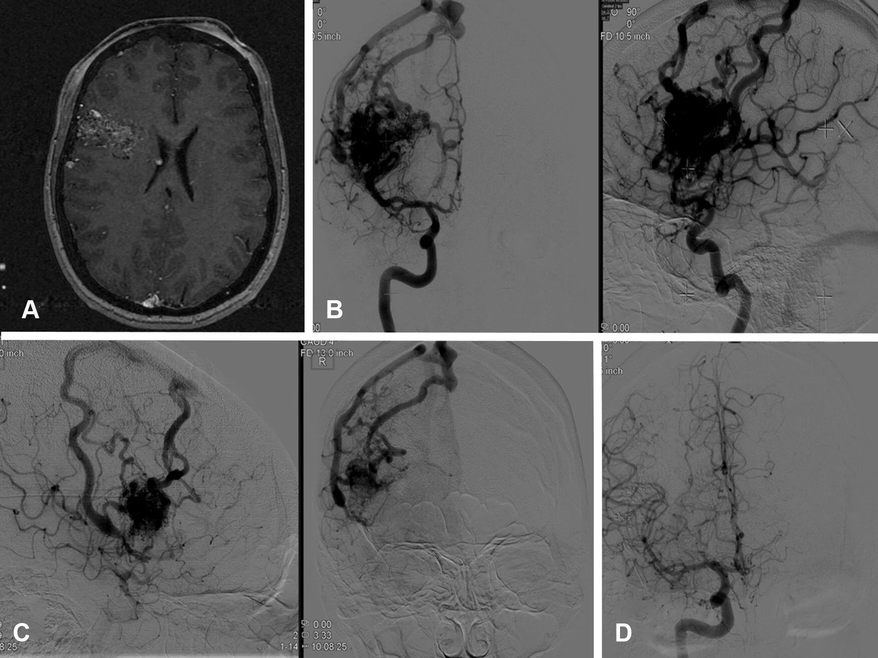 Cerebrovascular Neurosurgery — Sun Laboratory