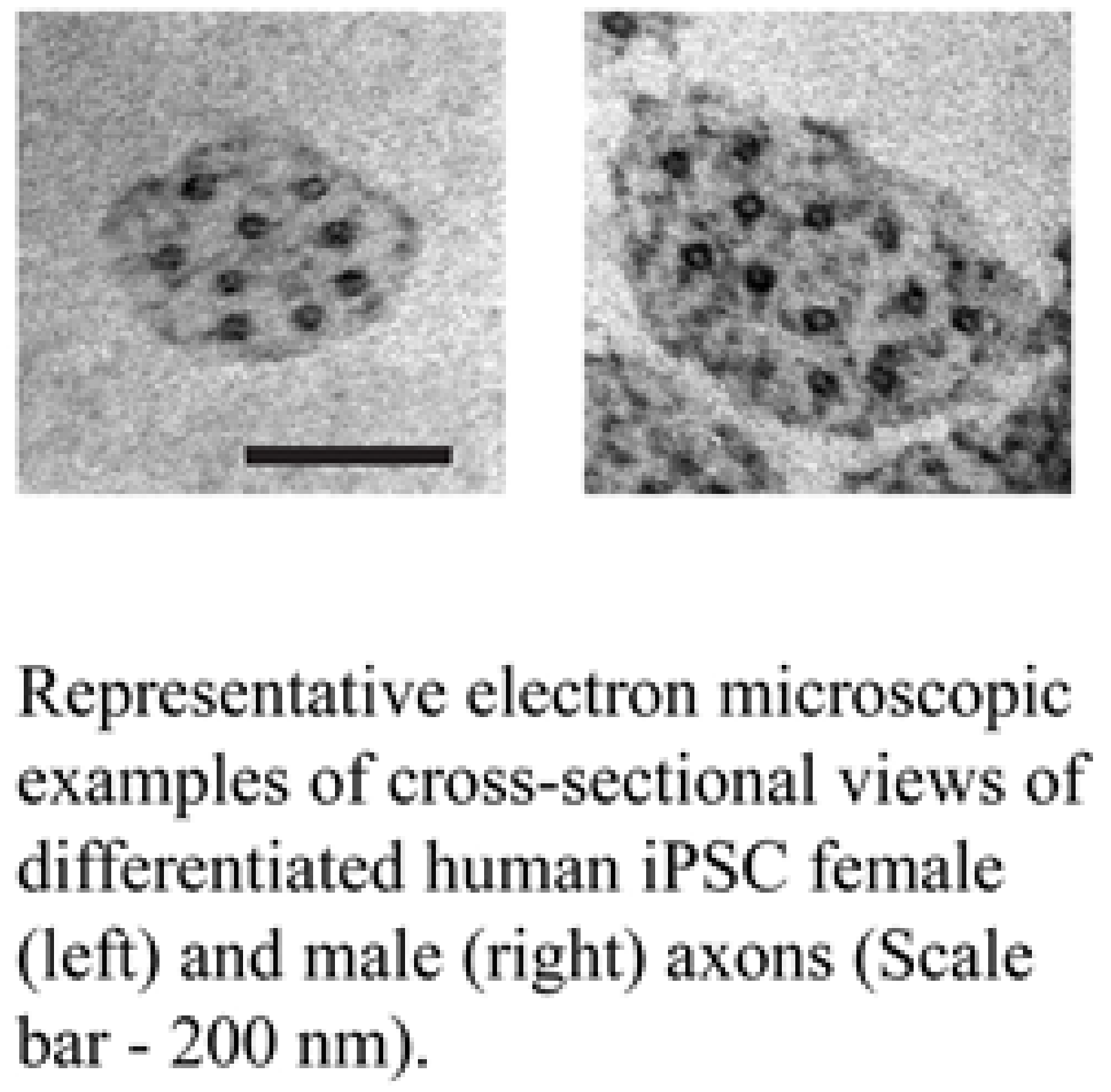 Concussion in Women and Girls — Concussion Alliance