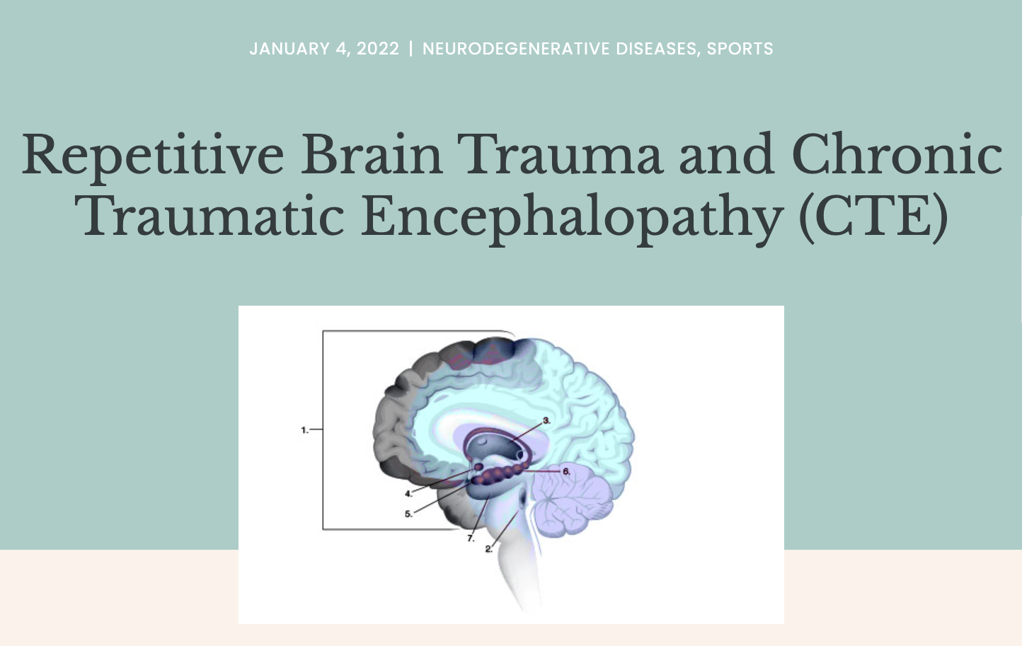 Neurodegenerative Diseases — Concussion Alliance