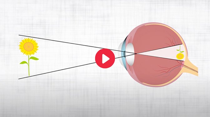 Vision Therapy — Concussion Alliance