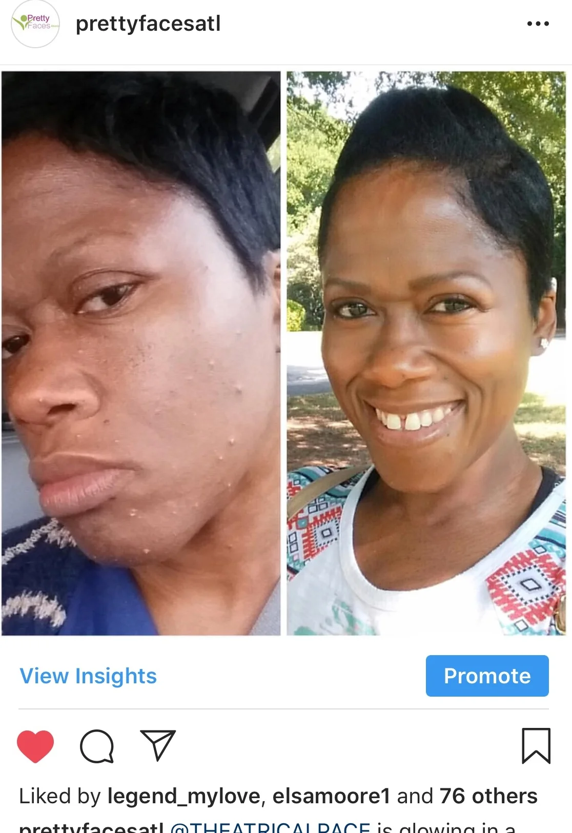 Skin Conditions — Pretty Faces Atlanta