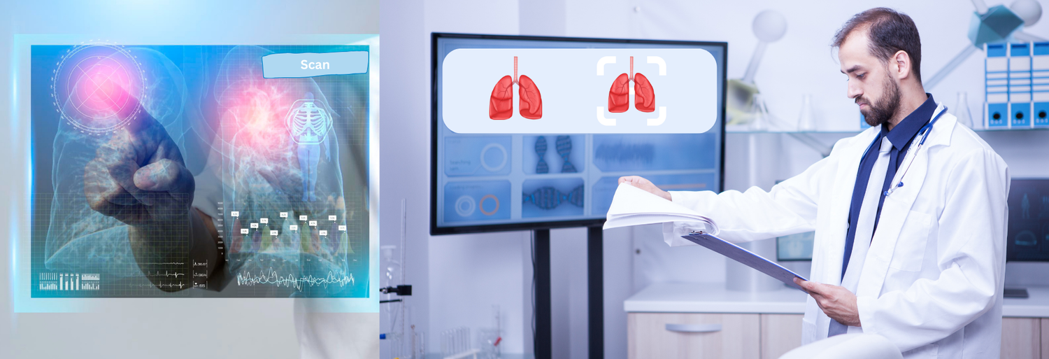 AI Lung Cancer Prediction — XECAN