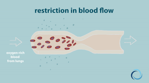 What Is Hyperbarics | Holistic Hyperbarics