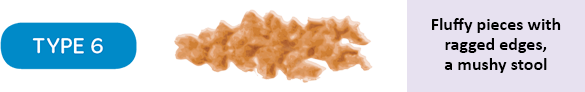 Bristol Stool Chart | OsmoLax Relief