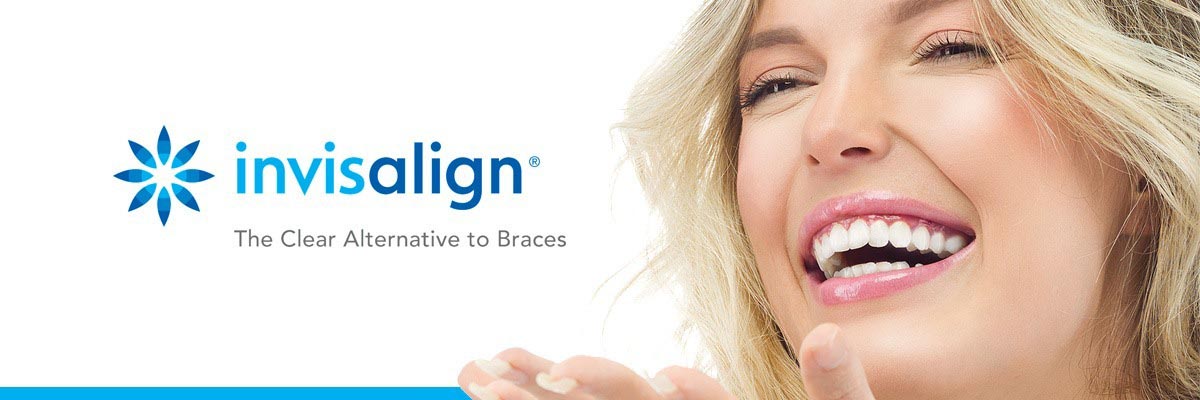 Invisalign — Bella Vita Dental- Dentist in Hillcrest