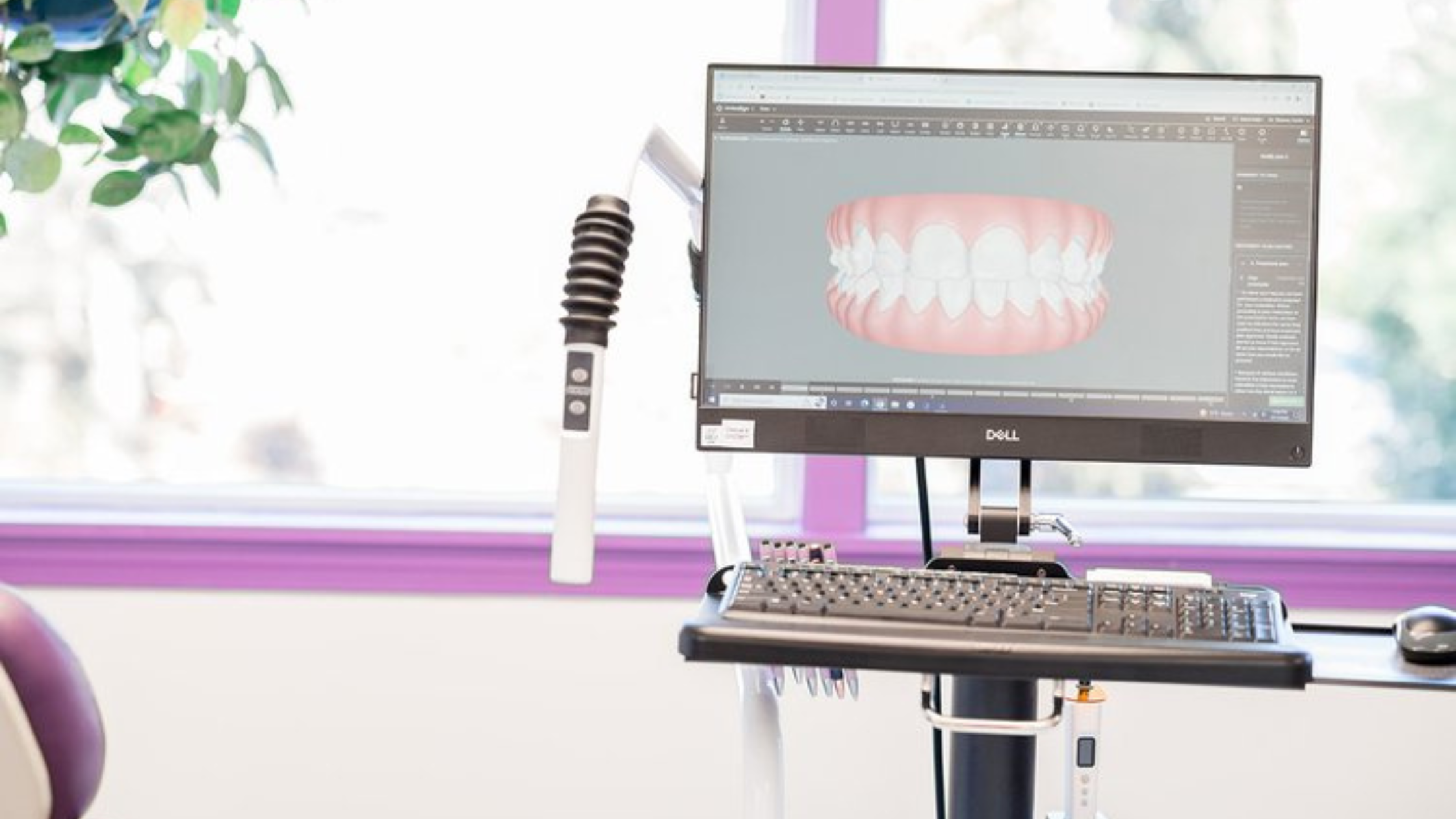 Dental Monitoring — Weaver Orthodontics