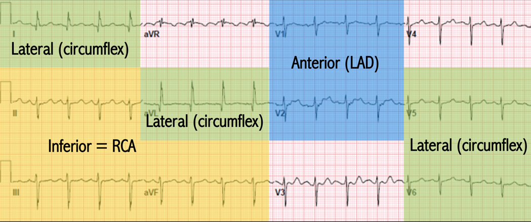Intern Ultrasound of the Month: POCUS & Regional Wall Motion ...