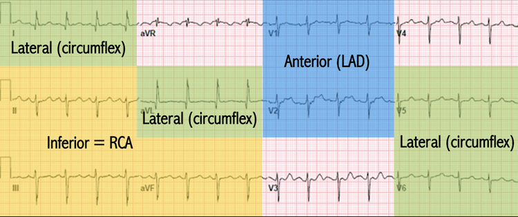 Intern Ultrasound of the Month: POCUS & Regional Wall Motion ...