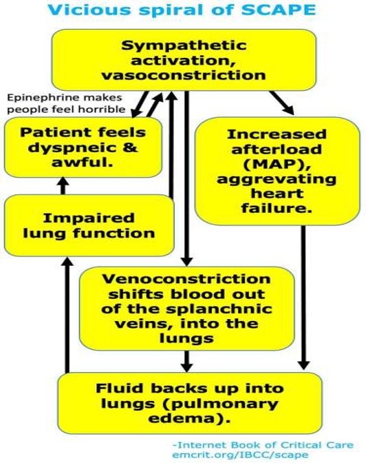 Resus: Diagnosis and Management of Sympathetic Crashing Acute Pulmonary ...