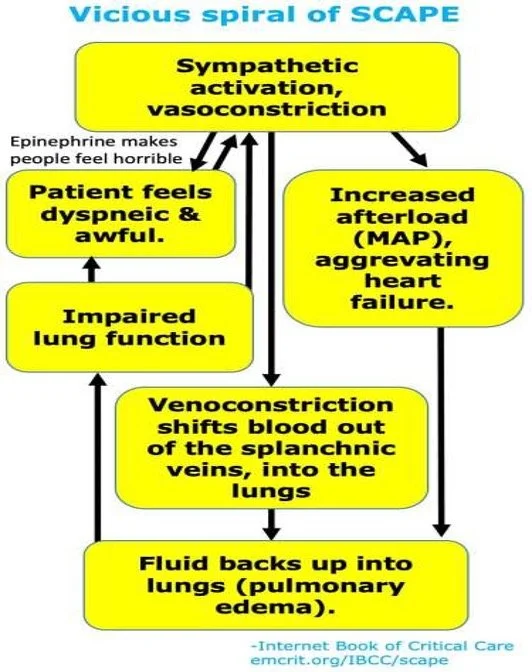 Resus: Diagnosis and Management of Sympathetic Crashing Acute Pulmonary ...
