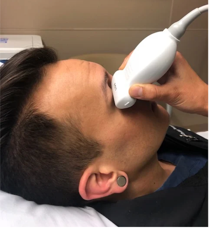 Ultrasound of the Month: Central Retinal Artery Occlusion — University ...