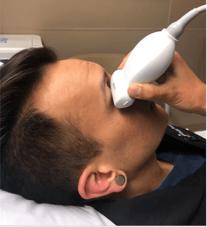 Ultrasound of the Month: Central Retinal Artery Occlusion — University ...