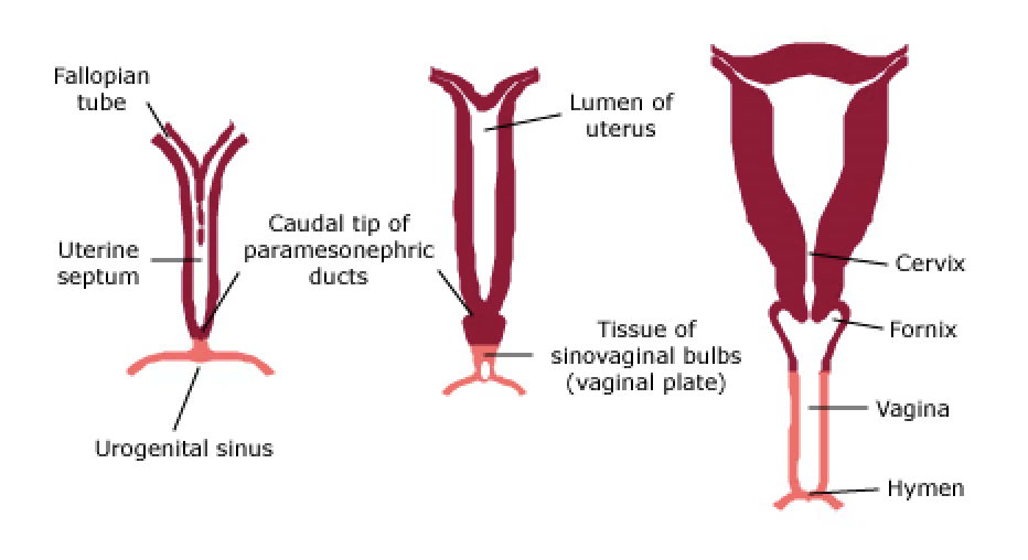 Case Presentation of Imperforate Hymen and the Utilization of Pelvic ...