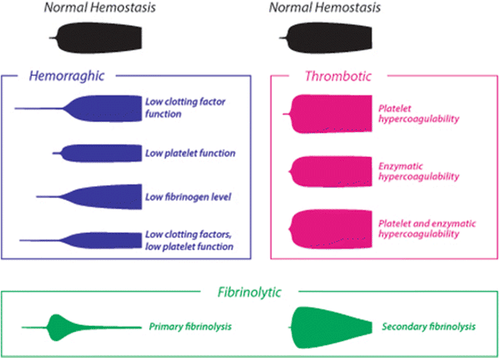 Resus: Thromboelastography (TEG) in Trauma Resuscitation — University ...