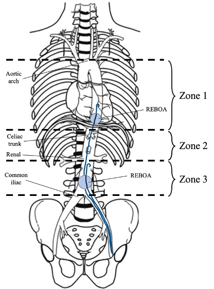 Resuscitation: A Review of the Methods, Benefits, Risks, and Clinical ...