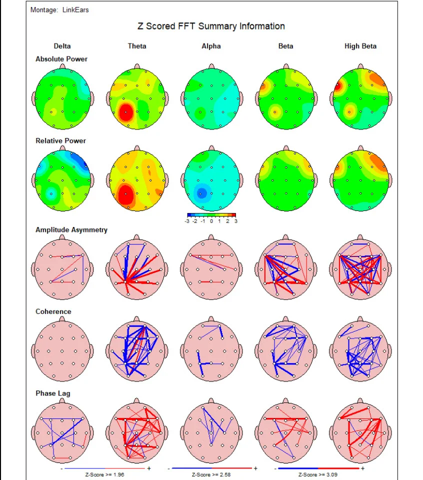 Standard Surface EEG — Brain Health and Biofeedback Clinic