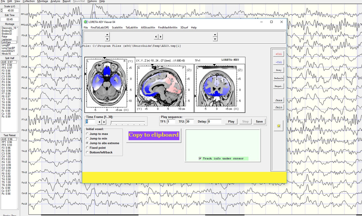 Loreta Brain Health And Biofeedback Clinic