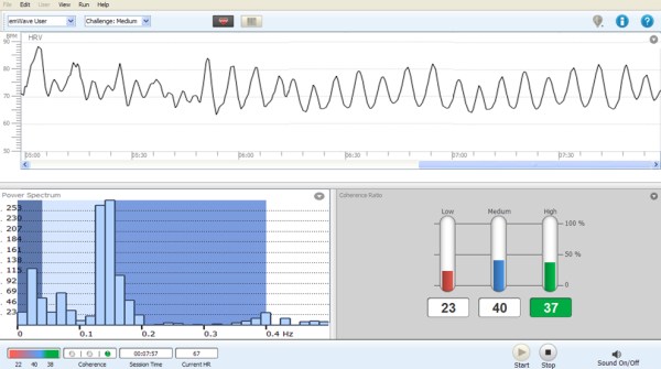 Heart Rate Variability Training — Brain Health and Biofeedback Clinic