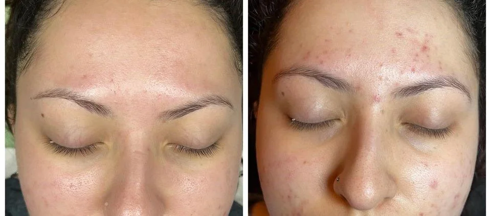 Advanced Facials — Flawless Skin Studio Body Wax and Skin Care