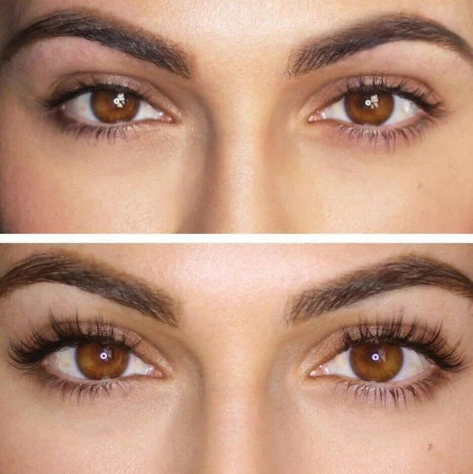 Cosmetic Dermatology — Fairview Dermatology