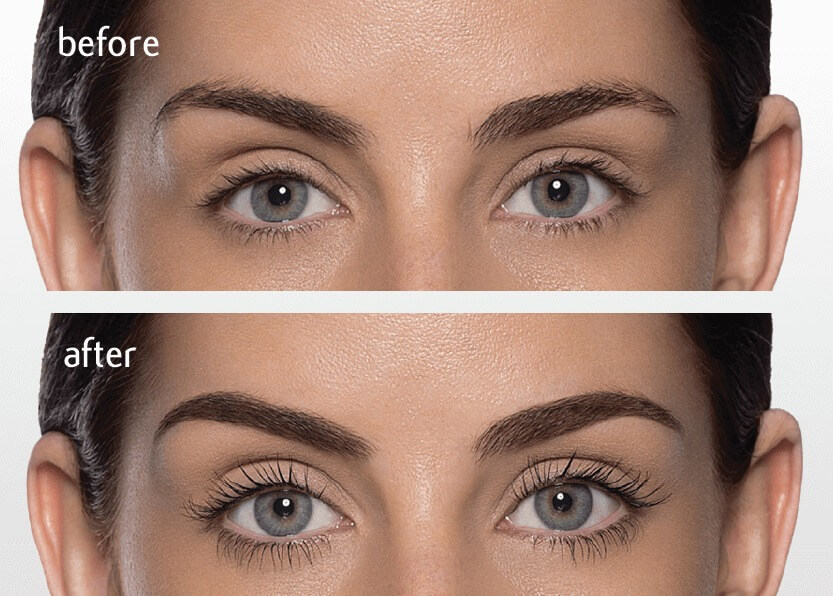 Eyelash Lift - Timeless Allure Skincare | Hatfield Peverel, Essex