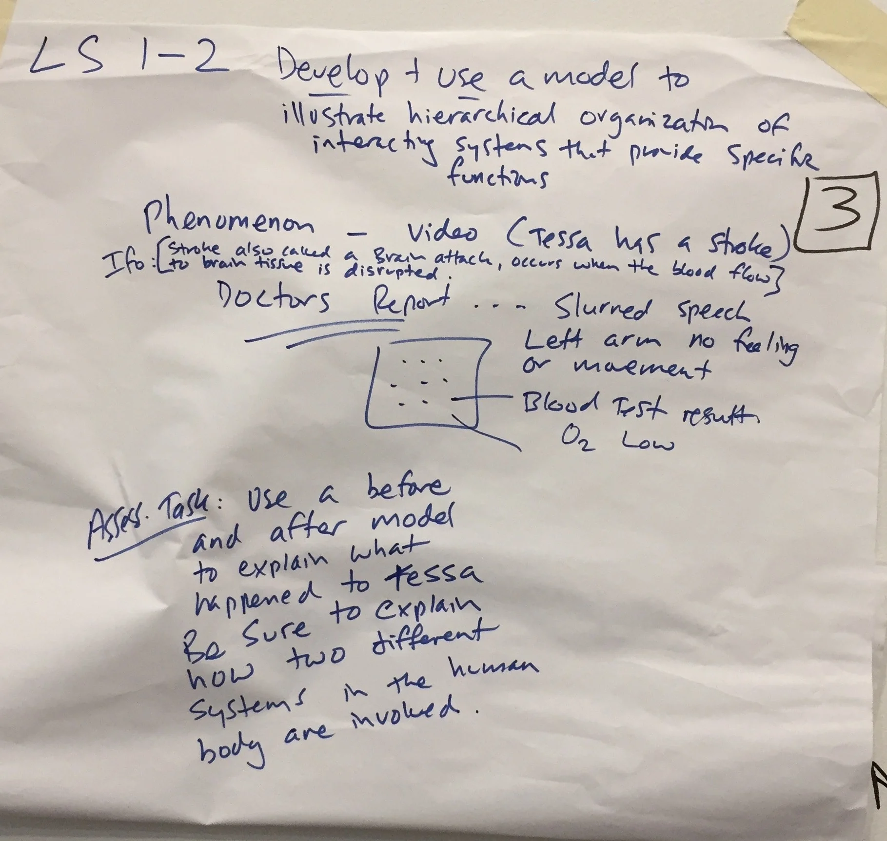 Stroke — The Wonder of Science