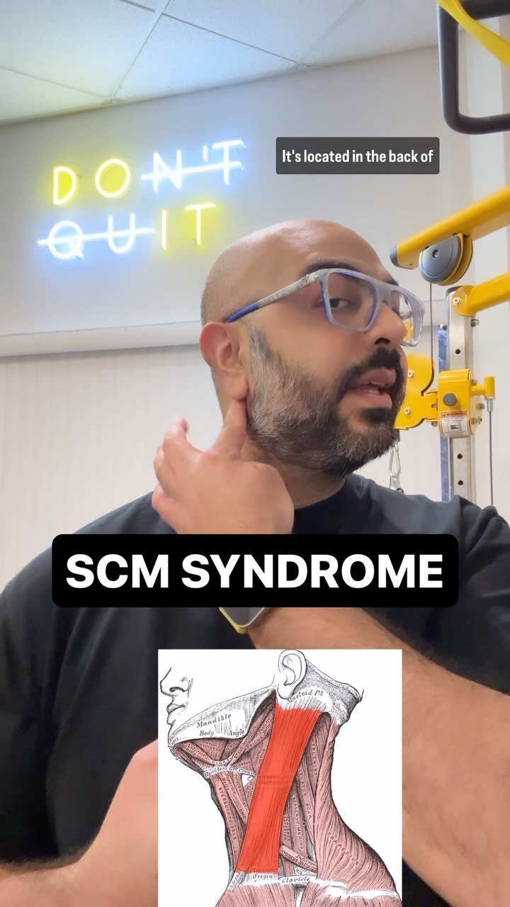 MOVABILITY — Understanding and Managing Sternocleidomastoid (SCM ...