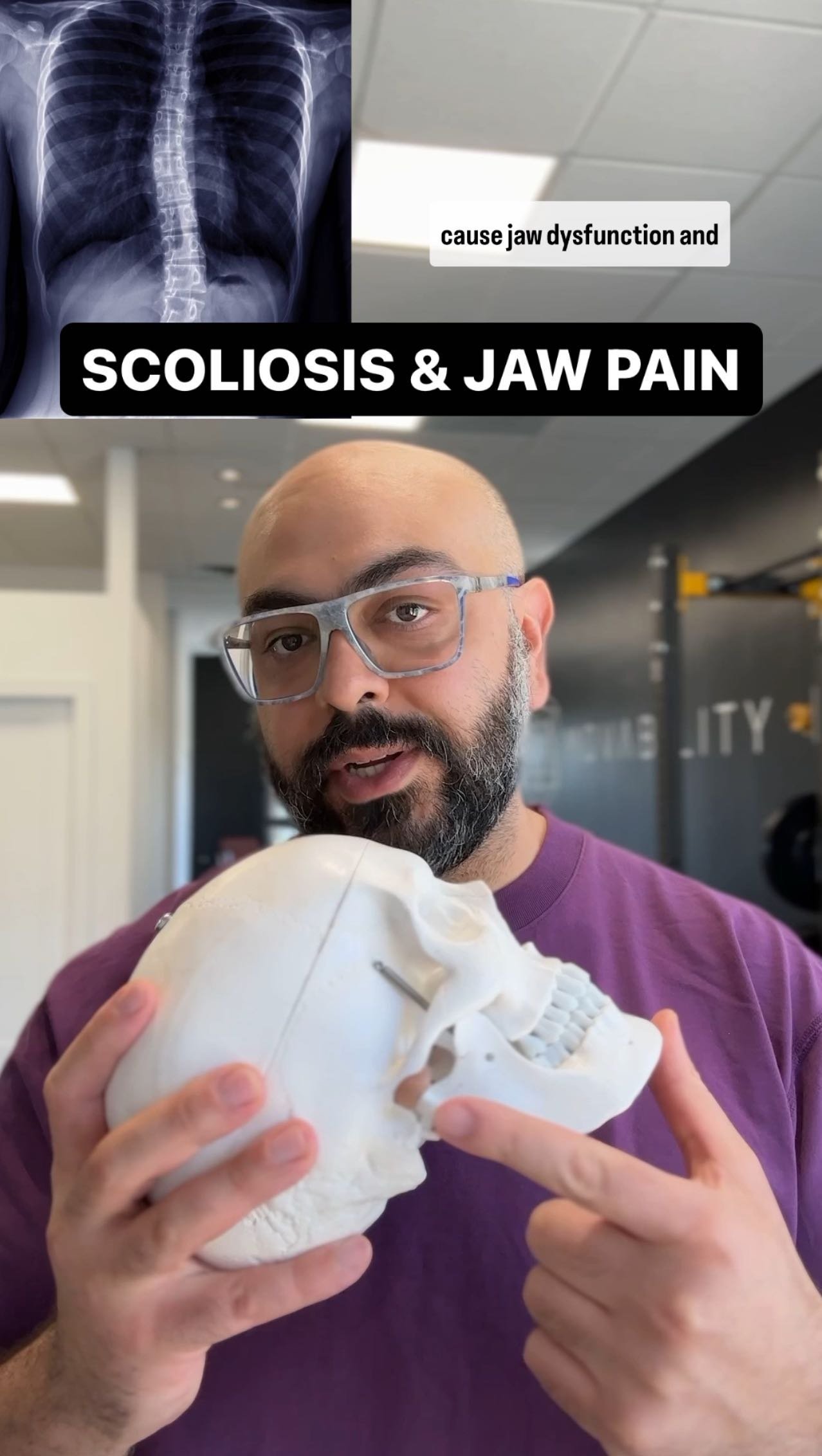 MOVABILITY — Understanding the Connection Between Scoliosis, TMJ ...