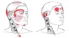 MOVABILITY — Understanding and Managing Sternocleidomastoid (SCM ...
