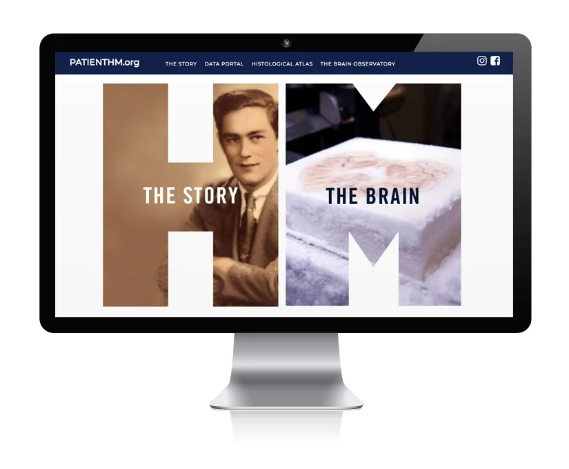 Research — THE BRAIN OBSERVATORY®