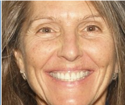 The strange disappearance of Fern Baird from the Prairie Peak Trail in ...