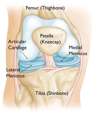 Meniscus Tear — Huang Orthopaedics