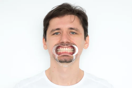 Smile design — Paramount Dental Studio