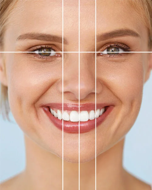 Smile design — Paramount Dental Studio