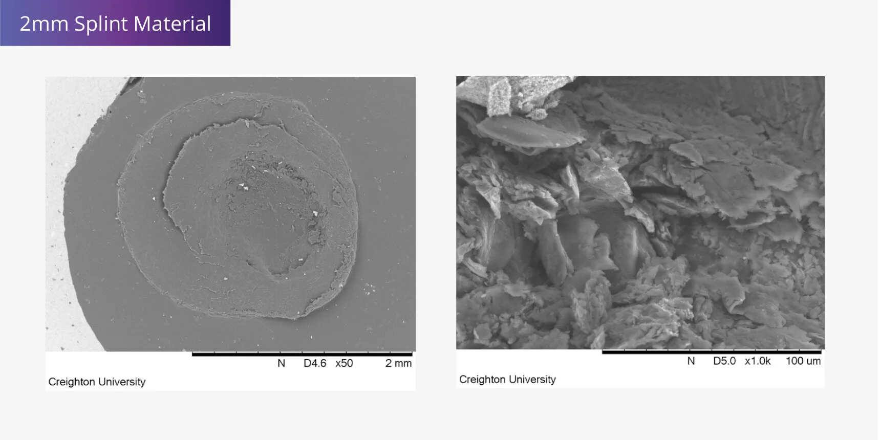 Occlusal guards — Paramount Dental Studio