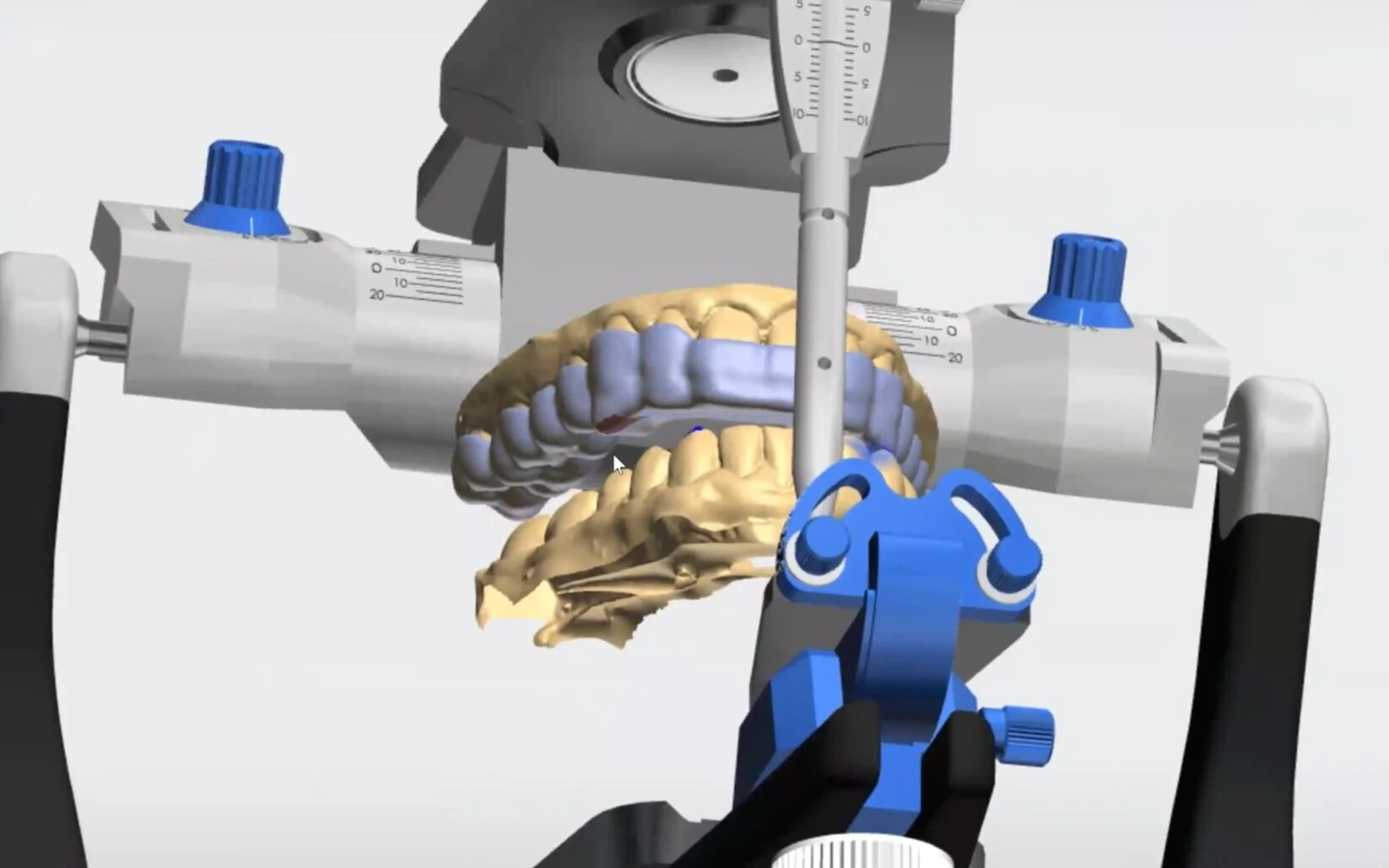 Occlusal guards — Paramount Dental Studio
