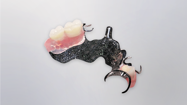 Picking A Digital Partial Denture — Paramount Dental Studio