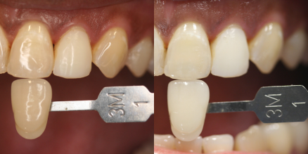 Lighting and Shade Protocol — Paramount Dental Studio