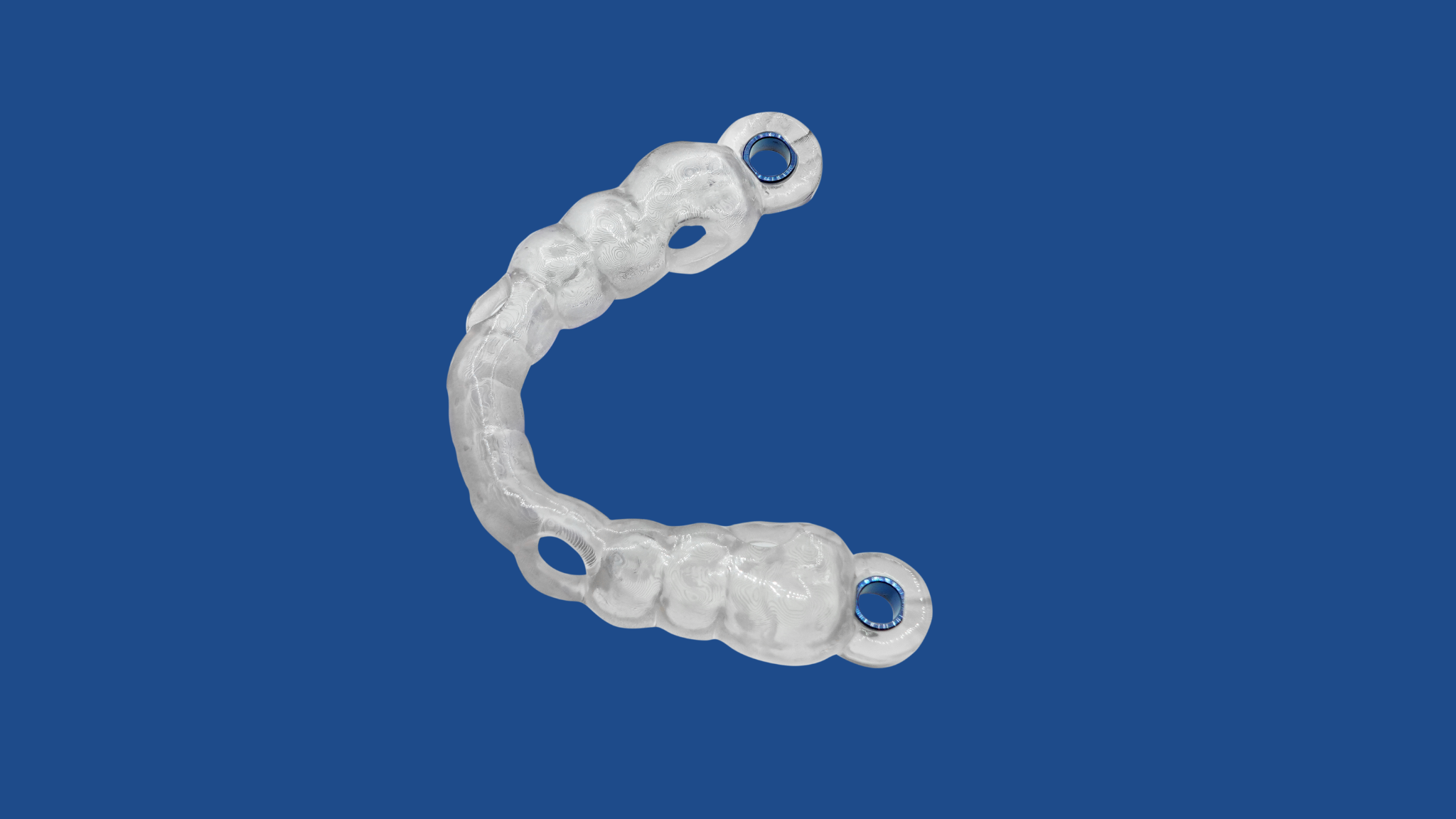 Surgical Guide Types and Workflows — Paramount Dental Studio