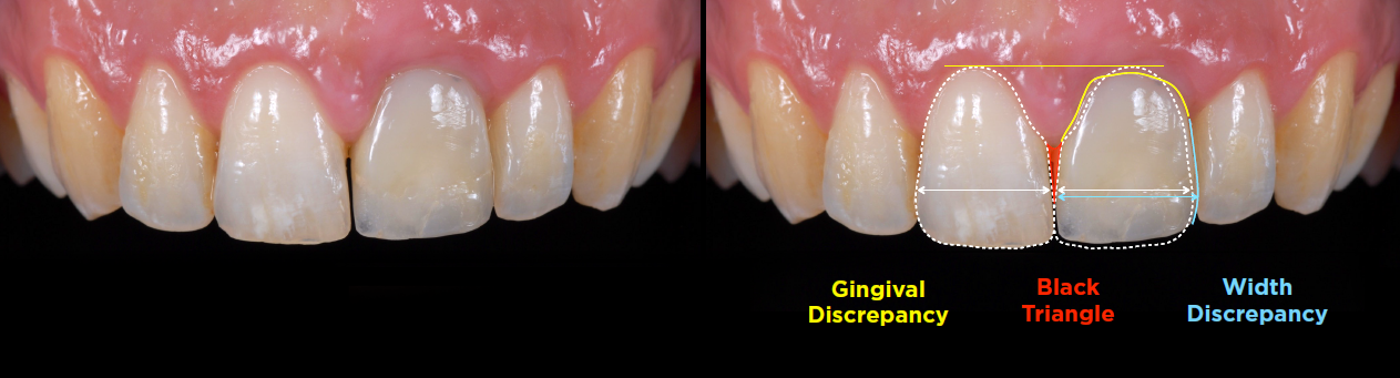 DSD_LP — Paramount Dental Studio